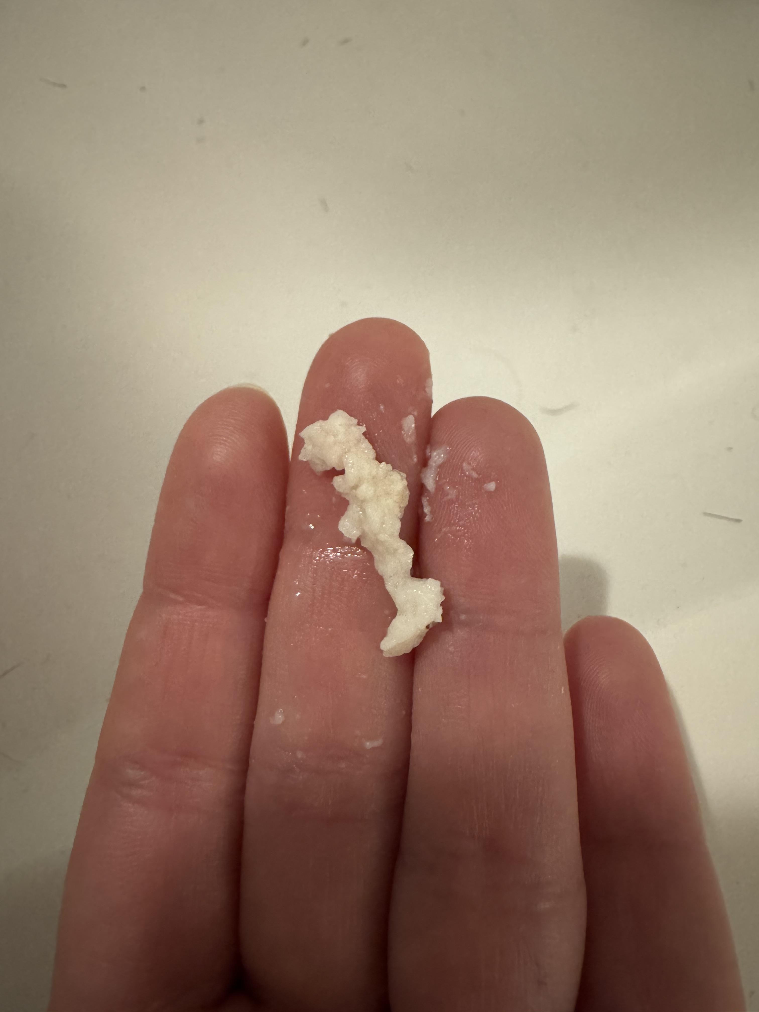 Zidoval (mot BV), normal utflod? Og spm om BV. TW, BILDE - Kropp og ...